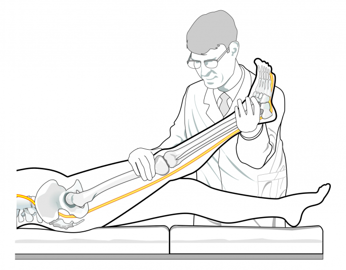 Sinal de Lasègue: principal teste para nervo ciático - Dr. Alberto Gotfryd