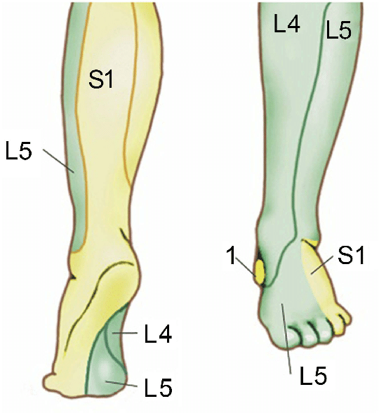 Lombociatalgia: principais causas e sintomas - Dr. Alberto Gotfryd