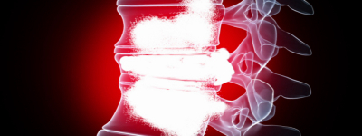 Tumores malignos da coluna - Dr. Alberto Gotfryd